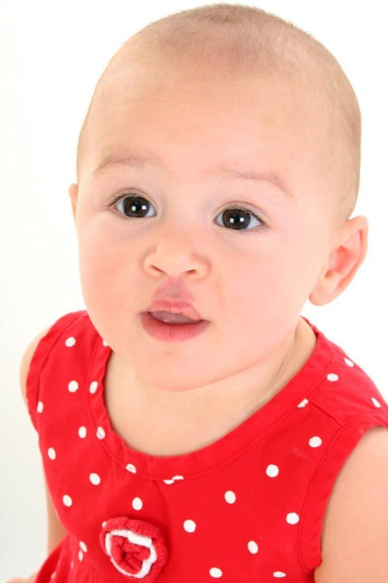 What do Stork Bite Birthmarks mean spiritually? - Awakening State