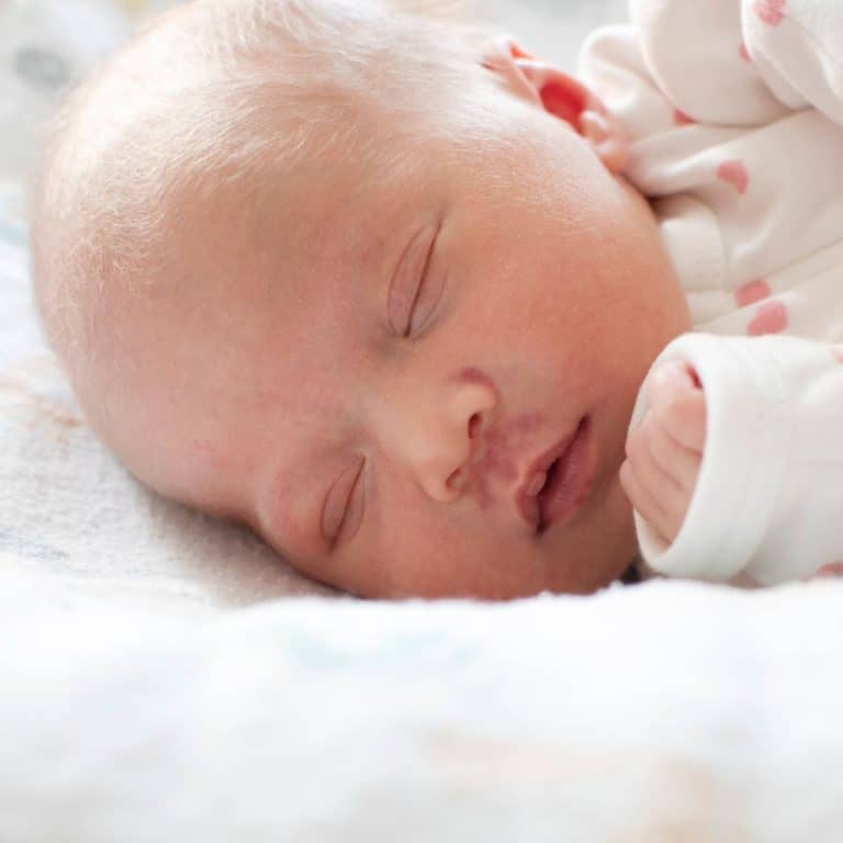 What do Stork Bite Birthmarks mean spiritually? - Awakening State