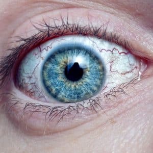 Limbal Ring: Spiritual Meaning (Dark Ring Around Eyes) - Awakening State