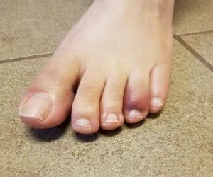Stubbing Your Toe Spiritual Meaning - Awakening State